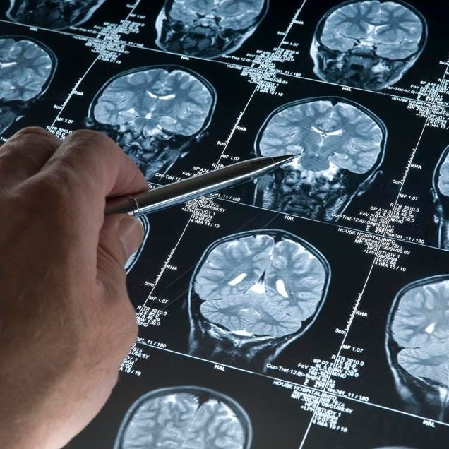Eli Lilly provides update on its A4 Study of solanezumab for ...