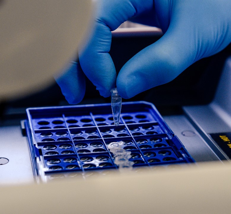 Csf Analysis Reveals Five Molecular Subtypes Of Ad According To New Research From Amsterdam Umc